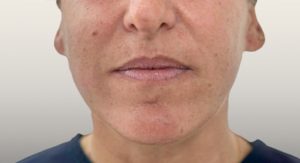 JULÄINE™ of Sweden | Evolving the Aesthetic Industry